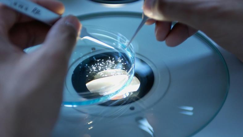 Na IRB-u došli do novih i važnih otkrića o kretanju stanica melanoma